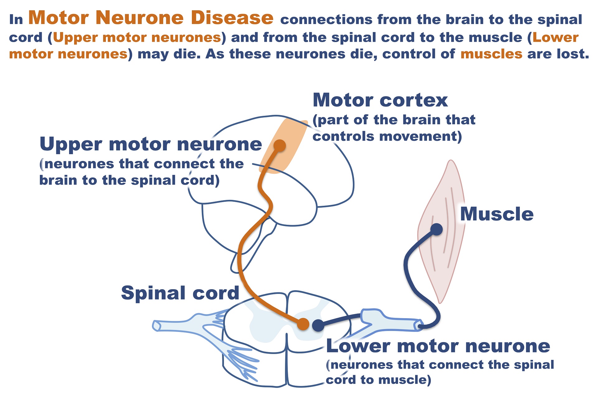 Living with MND - What's On Fraser Coast Magazine